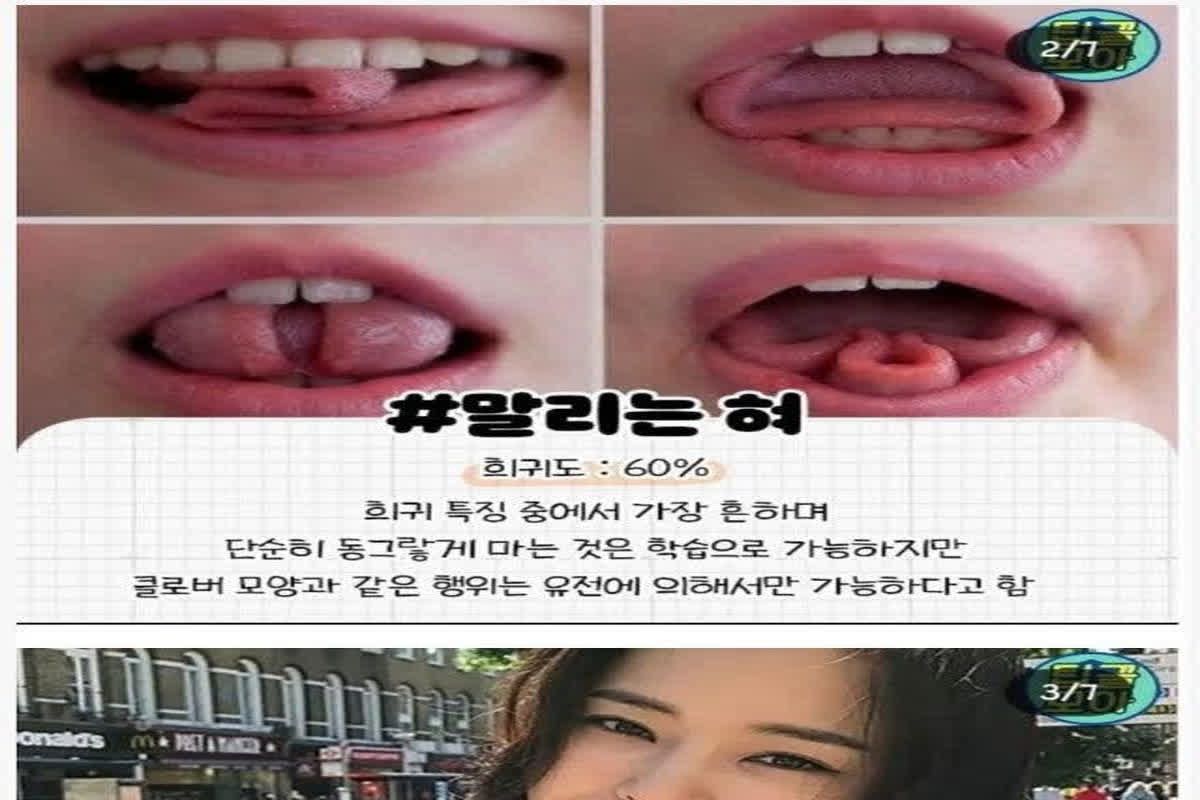 Rare human physical features