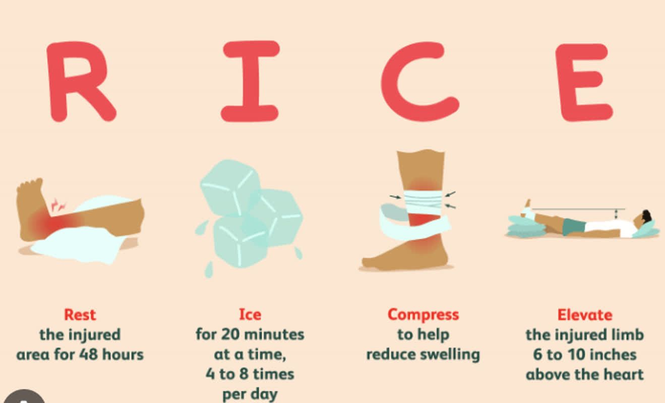 RICE therapy Rest Cold compress Compression, Elevation Self-care tips ...
