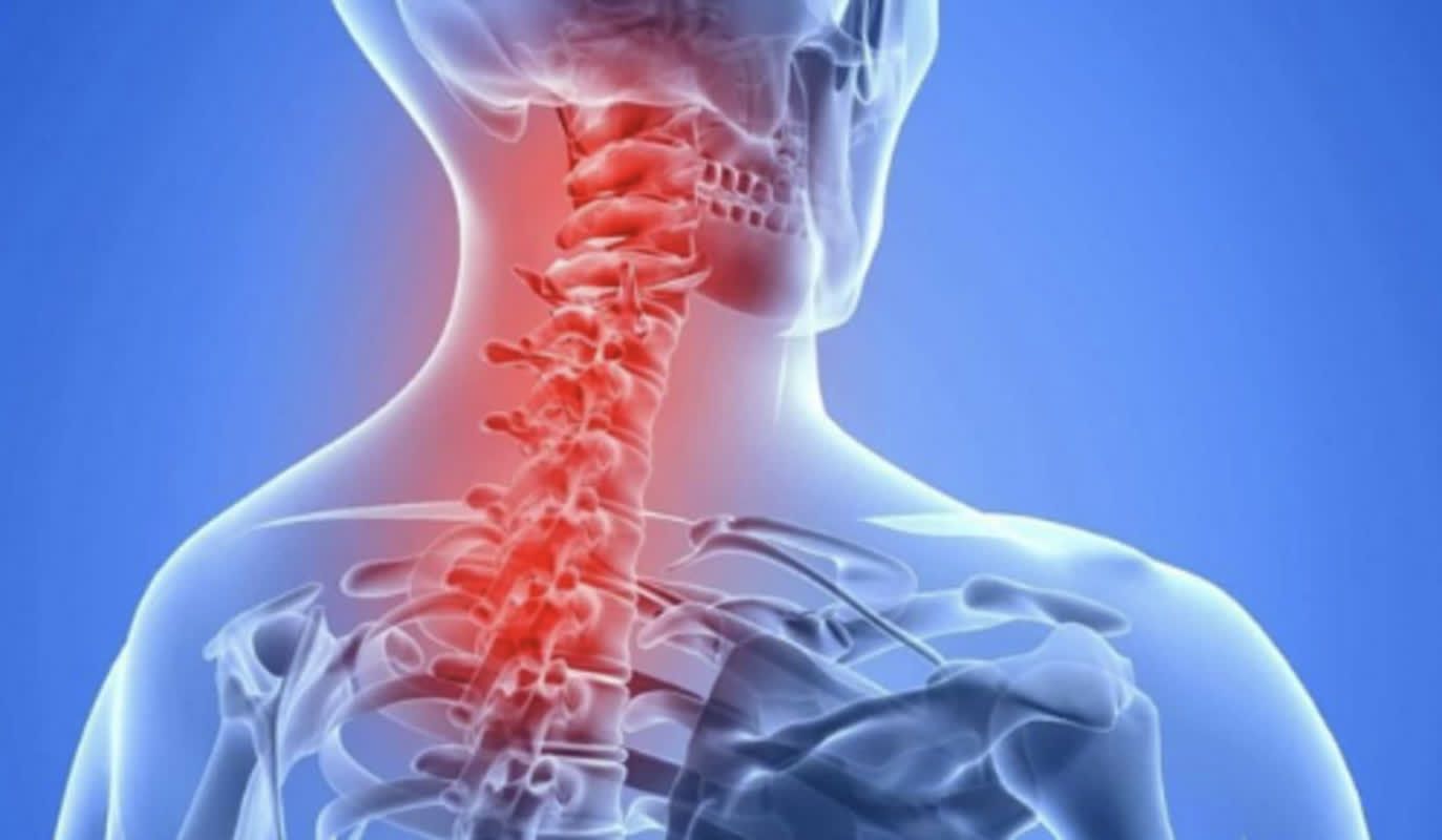 Boyun ağrısı, boyun ağrısı, nedenleri ve belirtileri, tedavi ve ...